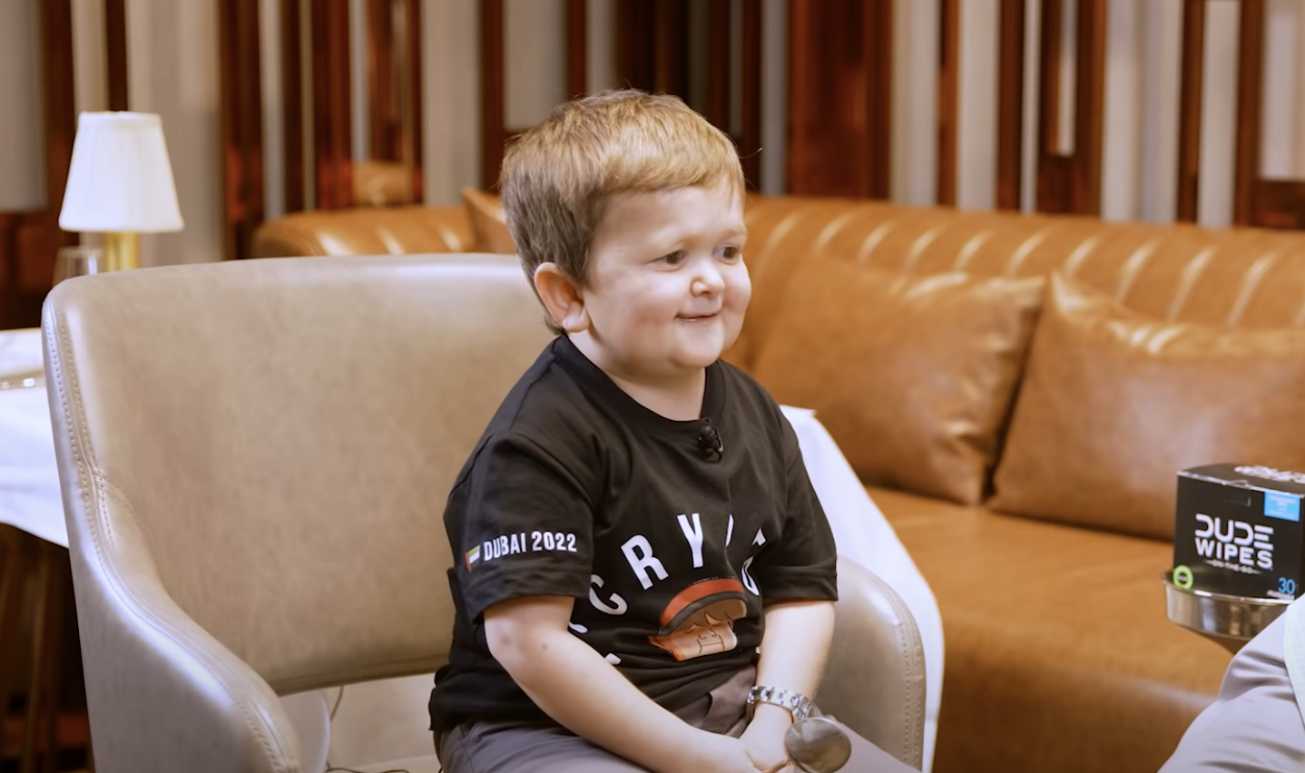 Viral Star Hasbulla Sits Down For His First Ever Interview - GRM Daily